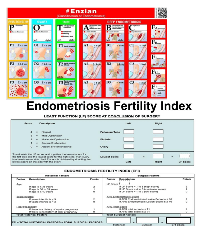 Endometriosis and subfertility – journey to be a specialist