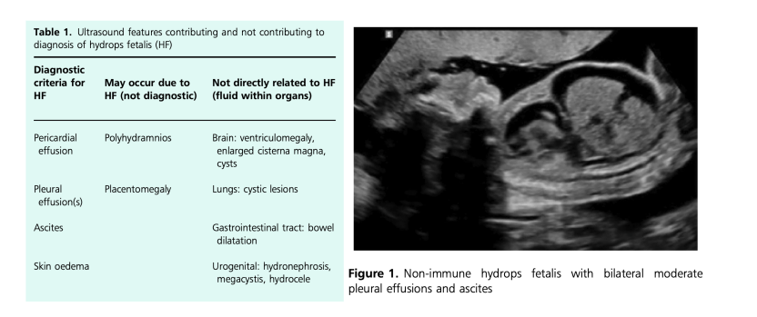 Non-immune hydrops fetalis – journey to be a specialist